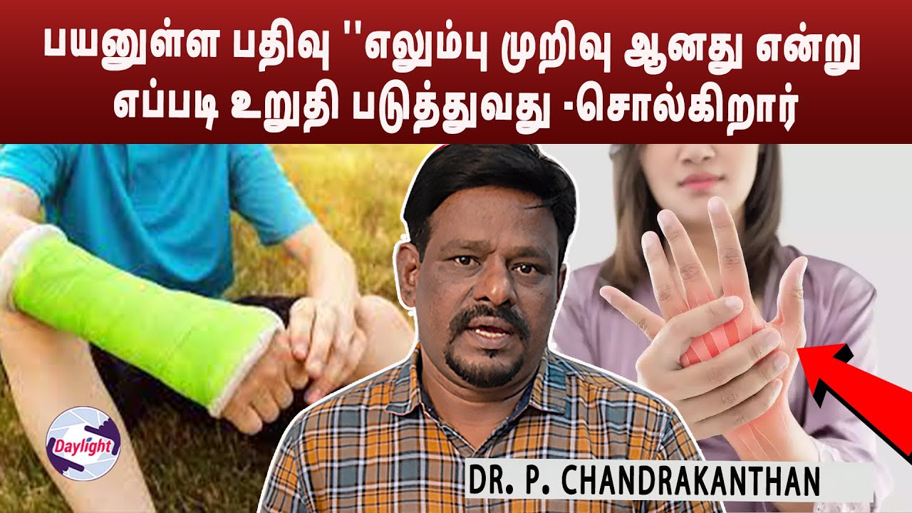 பயனுள்ள பதிவு ''எலும்பு முறிவு ஆனது என்று எப்படி உறுதி படுத்துவது ...