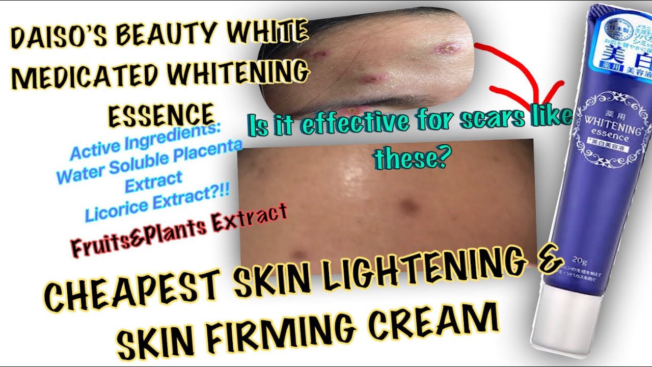 REVIEW | DAISO BIHAKU MEDICATED WHITENING ESSENCE: IS IT EFFECTIVE ...