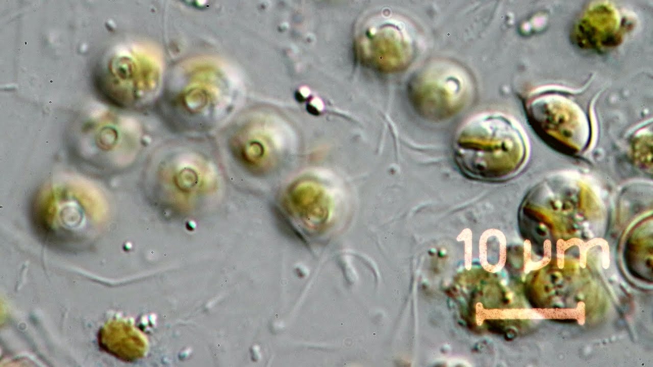 Lagynion delicatulum (Chrysophyceae) - YouTube