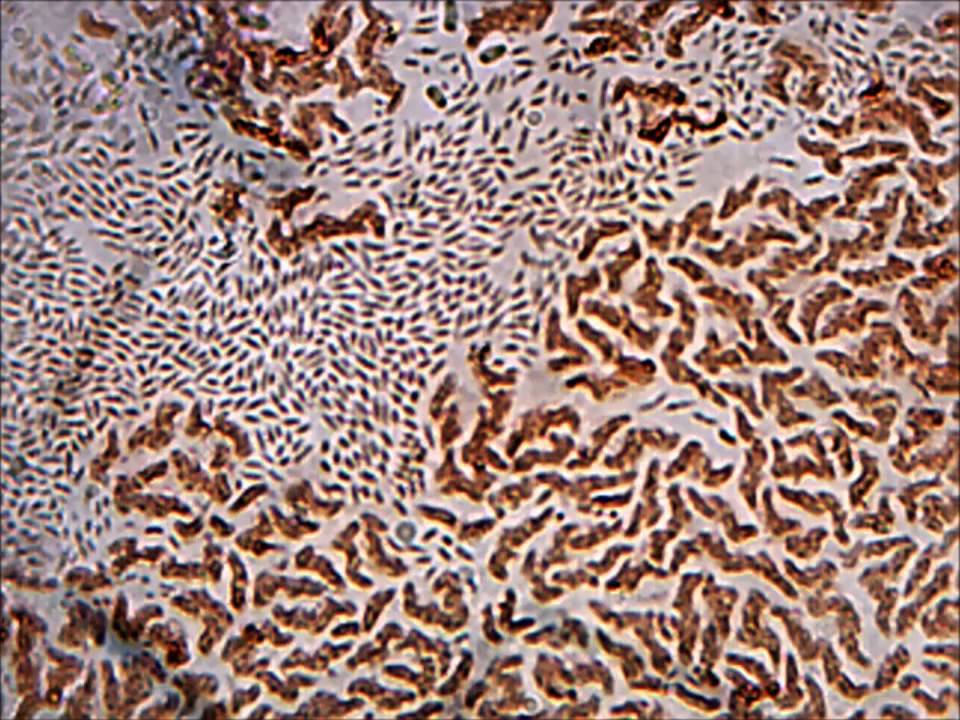 Neustonic bacteria - YouTube