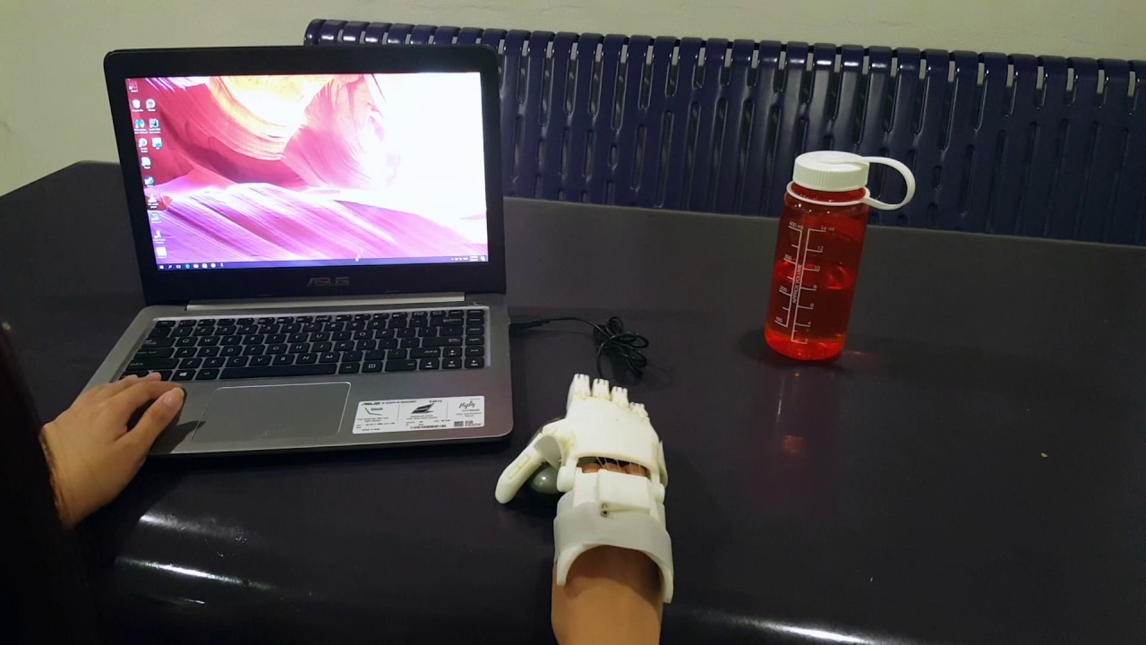 Phoenix Hand: Video Demonstration by BN4203 Students - YouTube