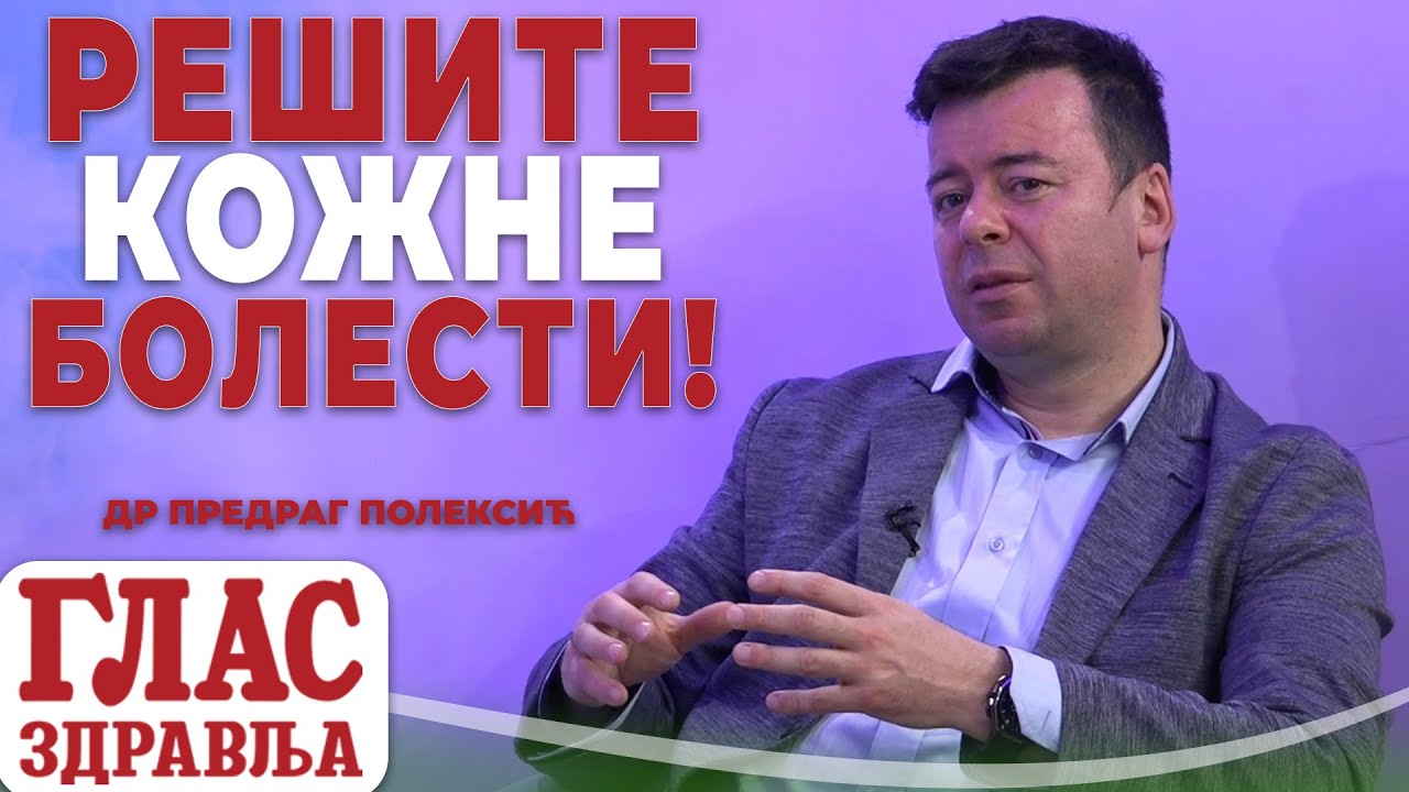 KAKO SE REŠITI ALOPECIJE, AKNI, OŽILJAKA I SUMNJIVIH MLADEŽA! OVO JE ...