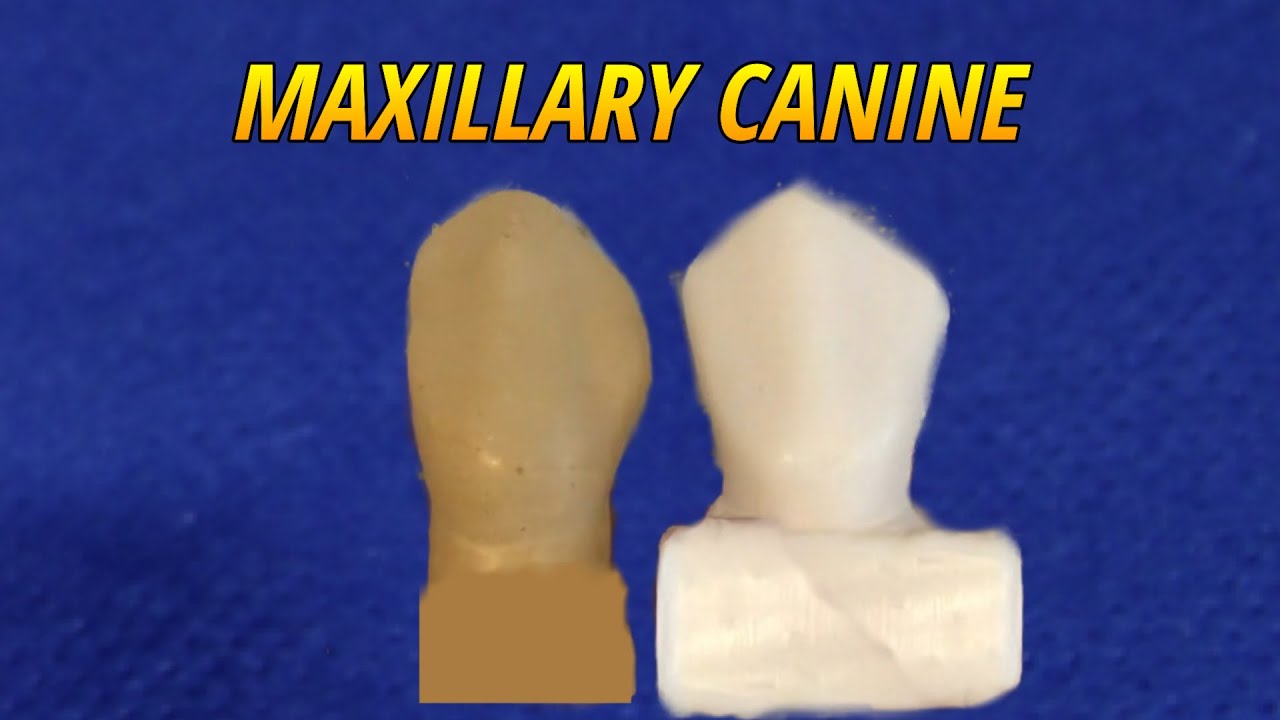 Carving of Maxillary Canine (Tooth Morphology) - YouTube