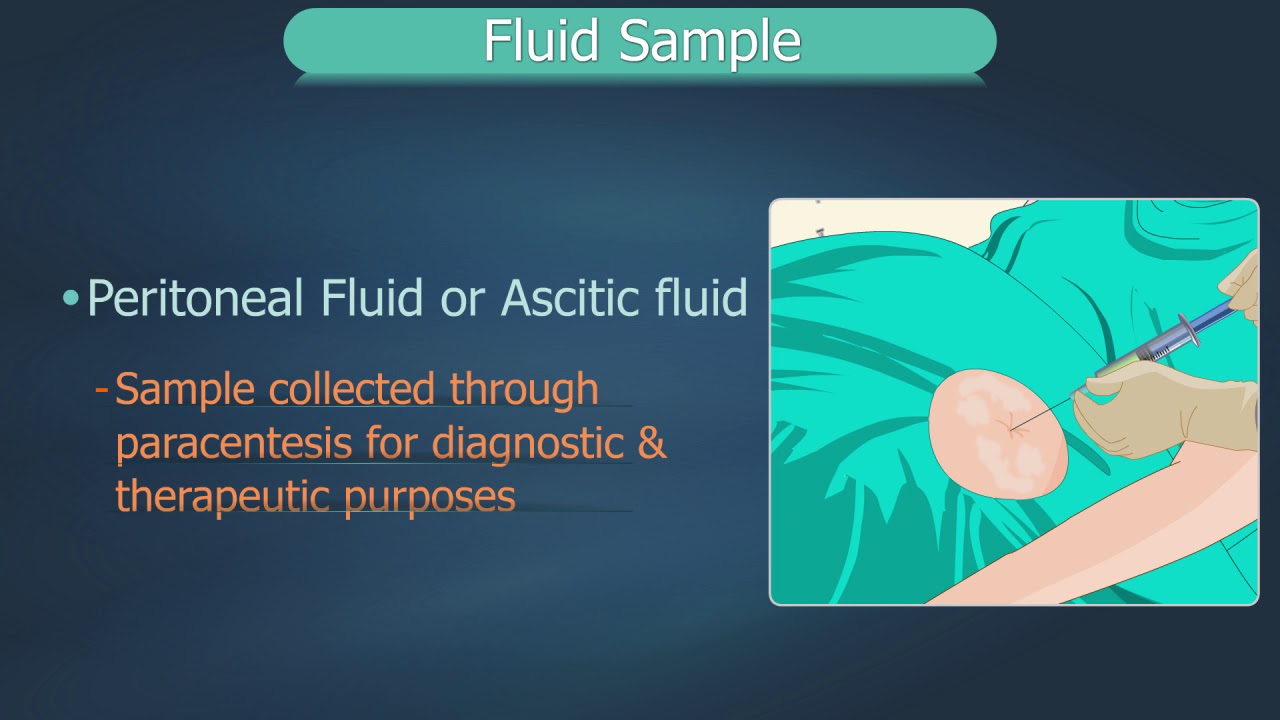 Fluid Examination General_ - YouTube