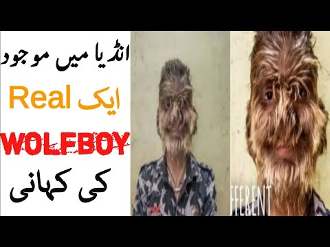 Real Life Wolf Boy In India | Unusual Humans - YouTube