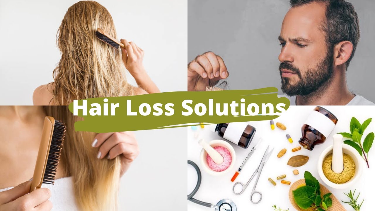 The Most Efficient Hair Loss Solutions (2020) - OVERCOME IT ...