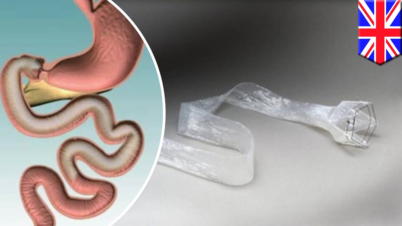 Artificial intestine can trick the brain into thinking it’s digesting ...