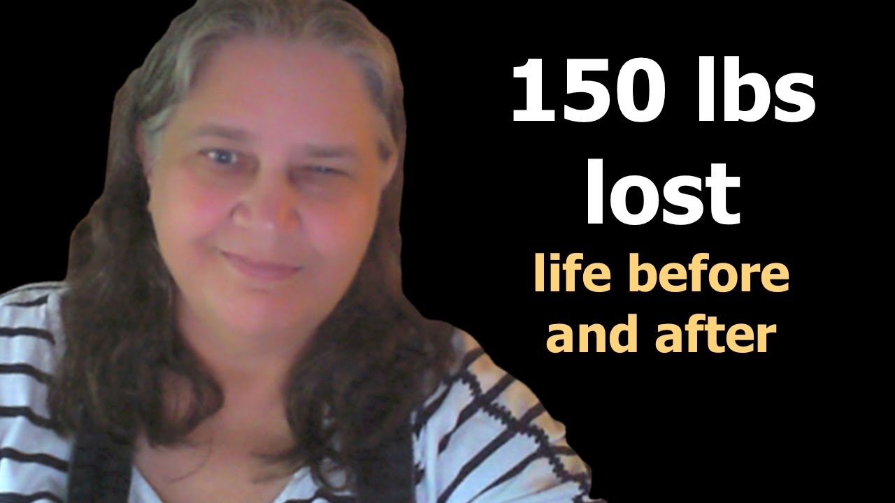 The TRUTH about life after losing 150 pounds - YouTube