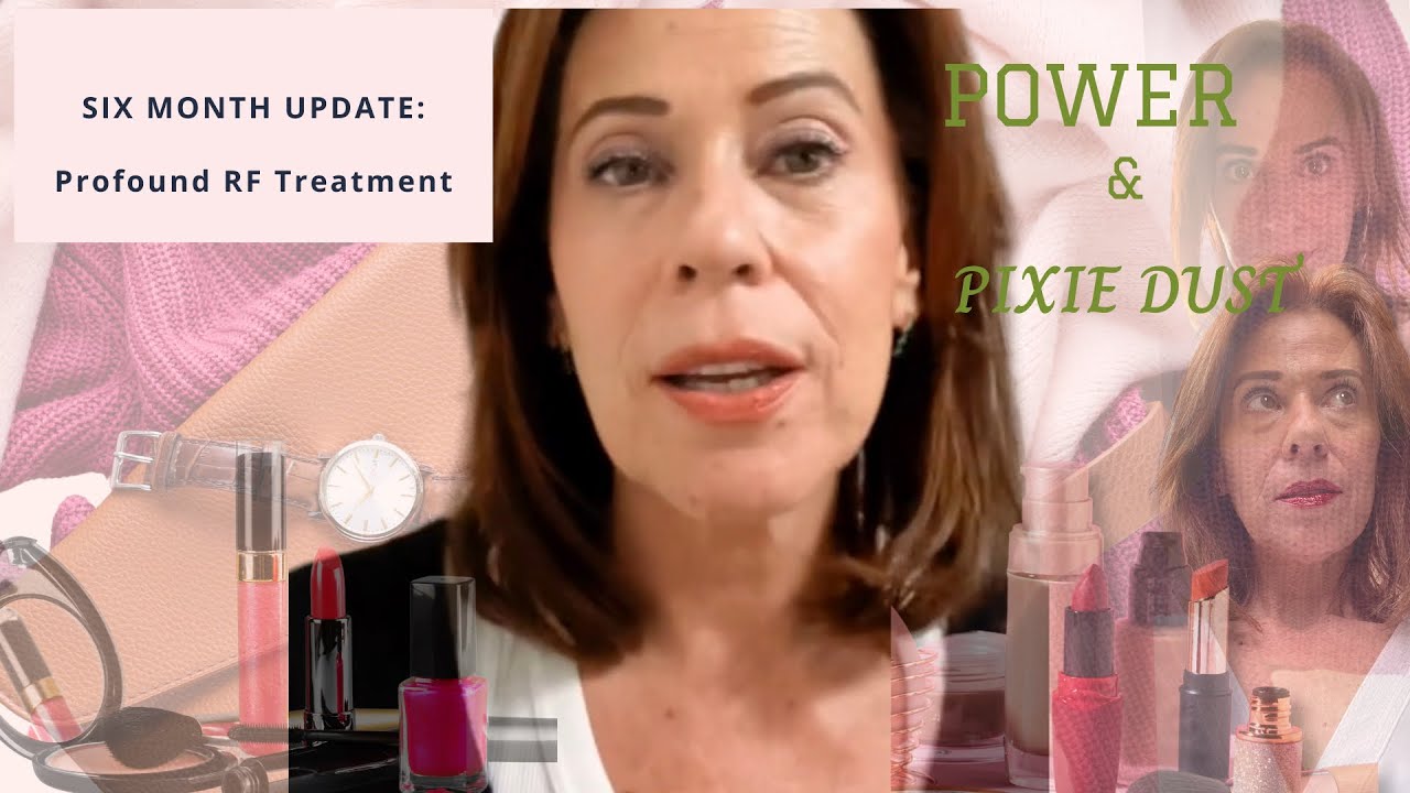 SIX MONTH UPDATE: Profound RF Treatment - YouTube