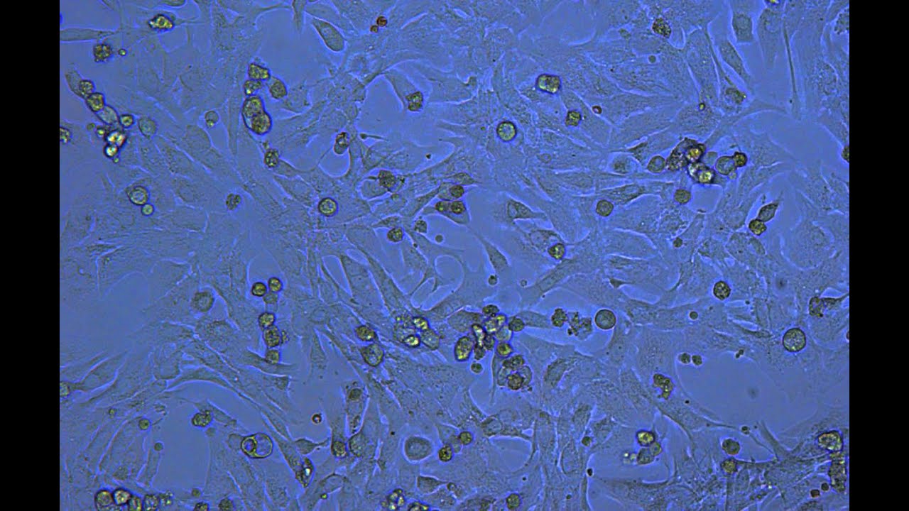 Beating Neonatal Rat Cardiomyocytes - YouTube