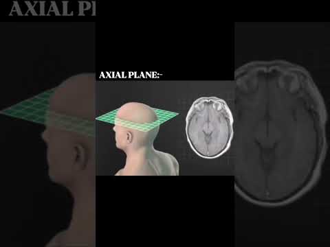 easy way to understand the cross section of axial plane#radiology # ...