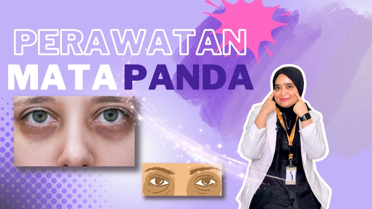Bagaimana sih cara merawat mata panda? - YouTube