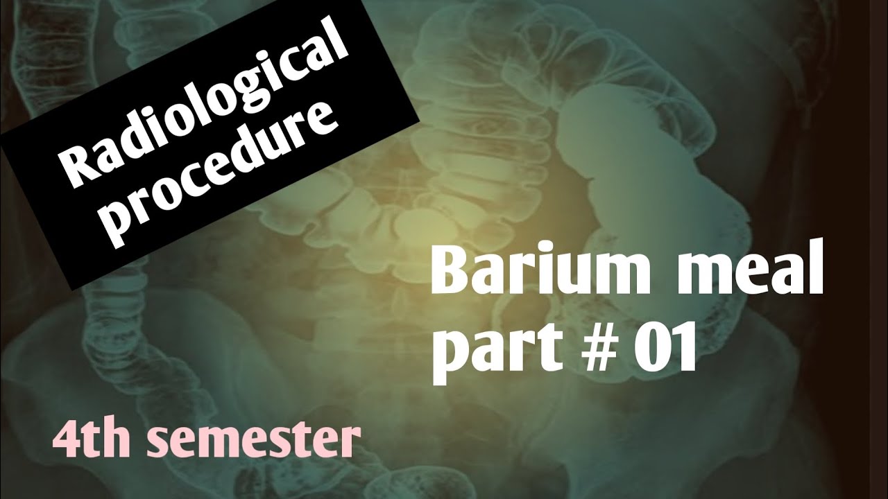 #barium meal//part #01//indications//methods//contraindications ...