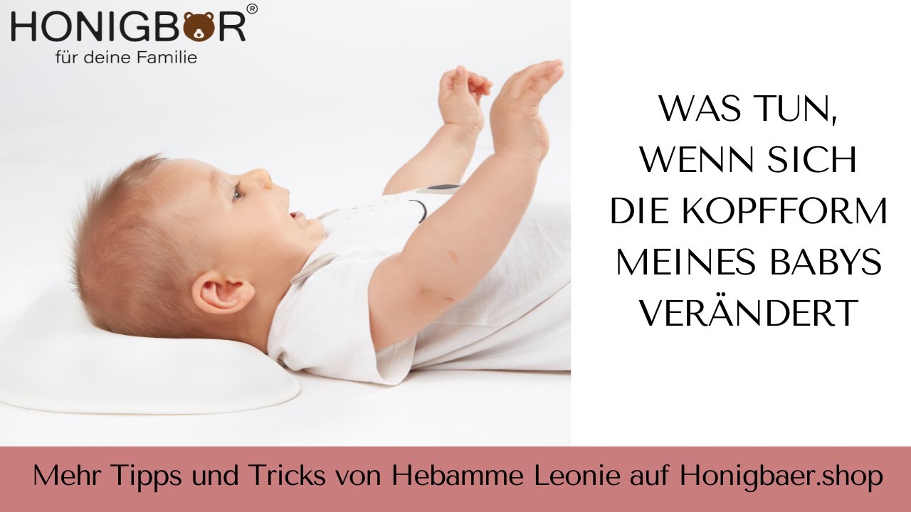 WAS TUN, WENN SICH DIE KOPFFORM MEINES BABYS VERÄNDERT? TIPPS GEGEN ...