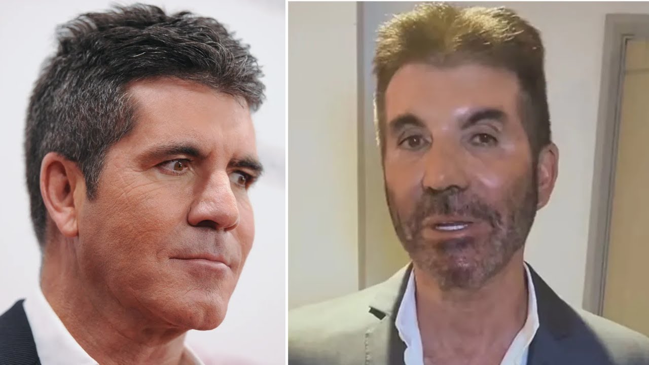 CELEBRITY BEFORE AND AFTER PLASTIC SUERGERY | Simon Cowell | - YouTube
