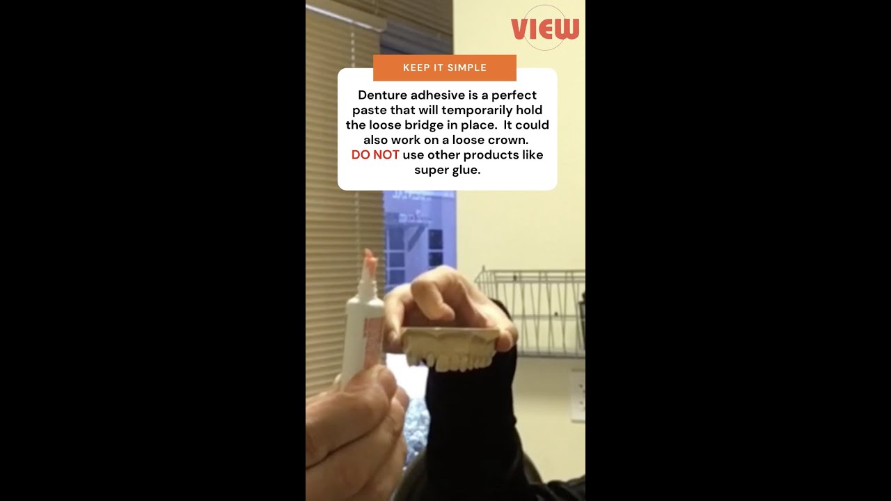 Temporarily Re-Cement a Loose Bridge with Denture Adhesive | View ...