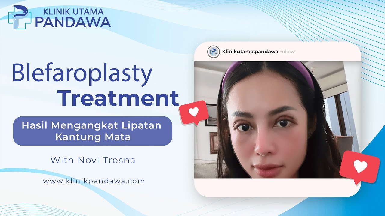 TIPS MATA CANTIK OPERASI EYELID ATAU BLEFAROPASTI | NOVI TRESNA ...