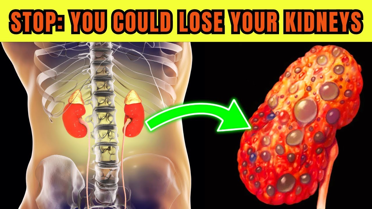 12 BAD Habits That Damage Your KIDNEYS - YouTube
