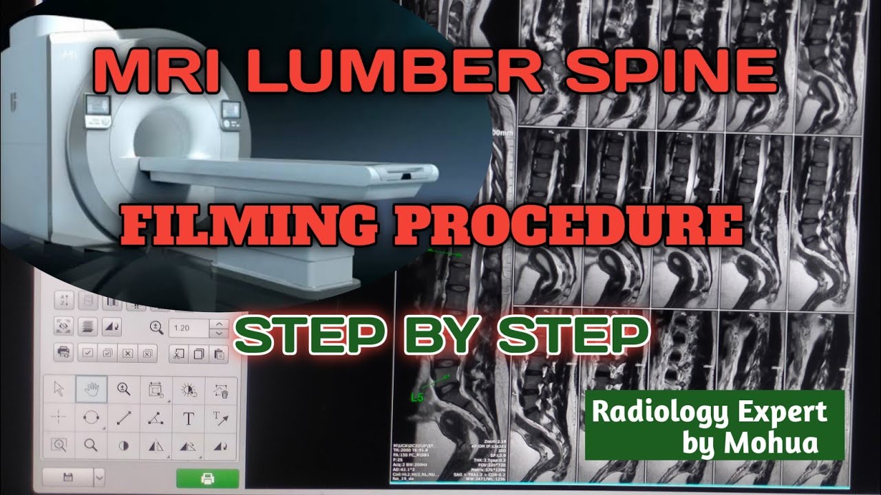 MRI LUMBER SPINE FILMING PROCEDURE || STEP BY STEP || - YouTube