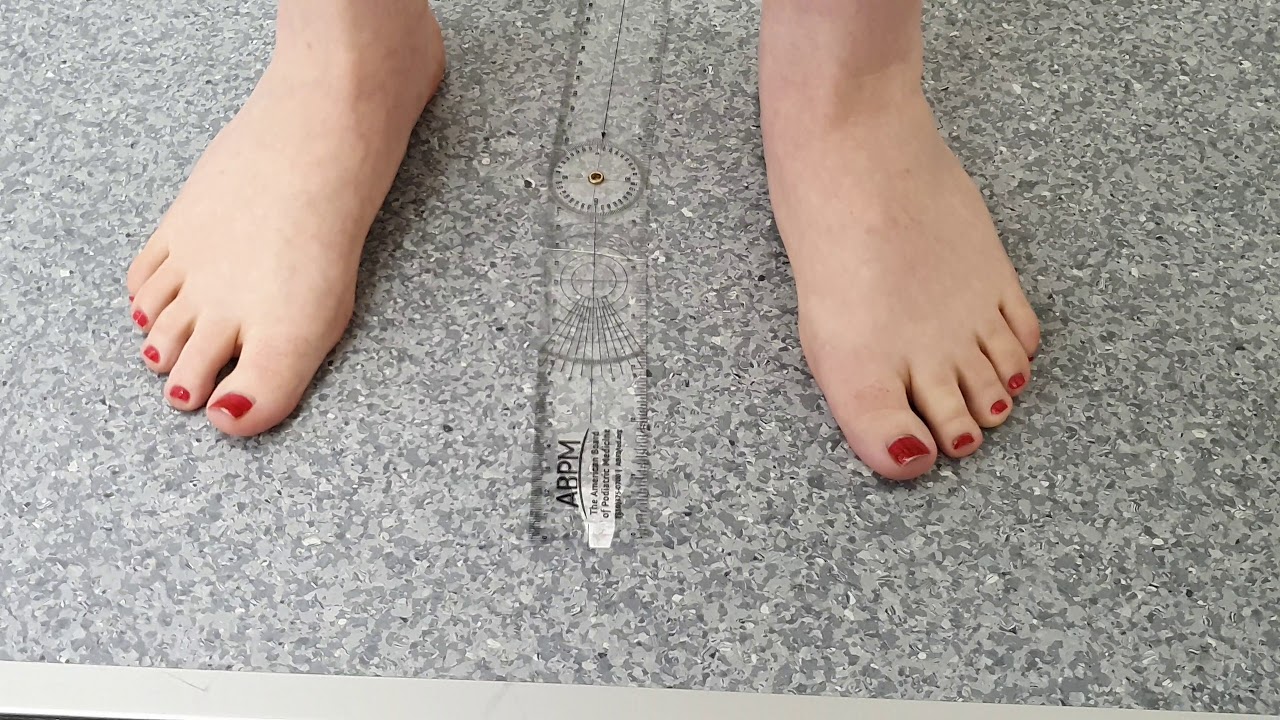 Angle and base of gait - YouTube