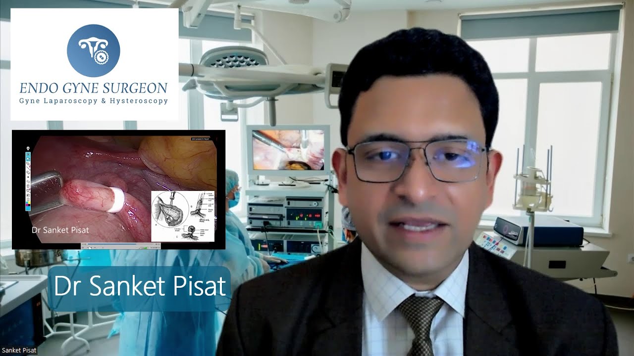 Patient Info | Laparoscopic Tubal Ligation surgery - with voiceover ...