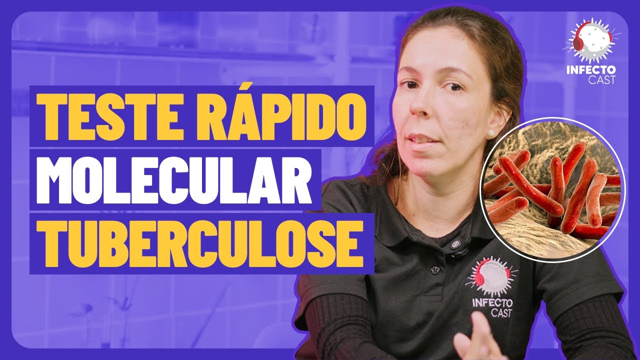 TRM-TB: O exame rápido para diagnóstico de Tuberculose no Brasil! - YouTube
