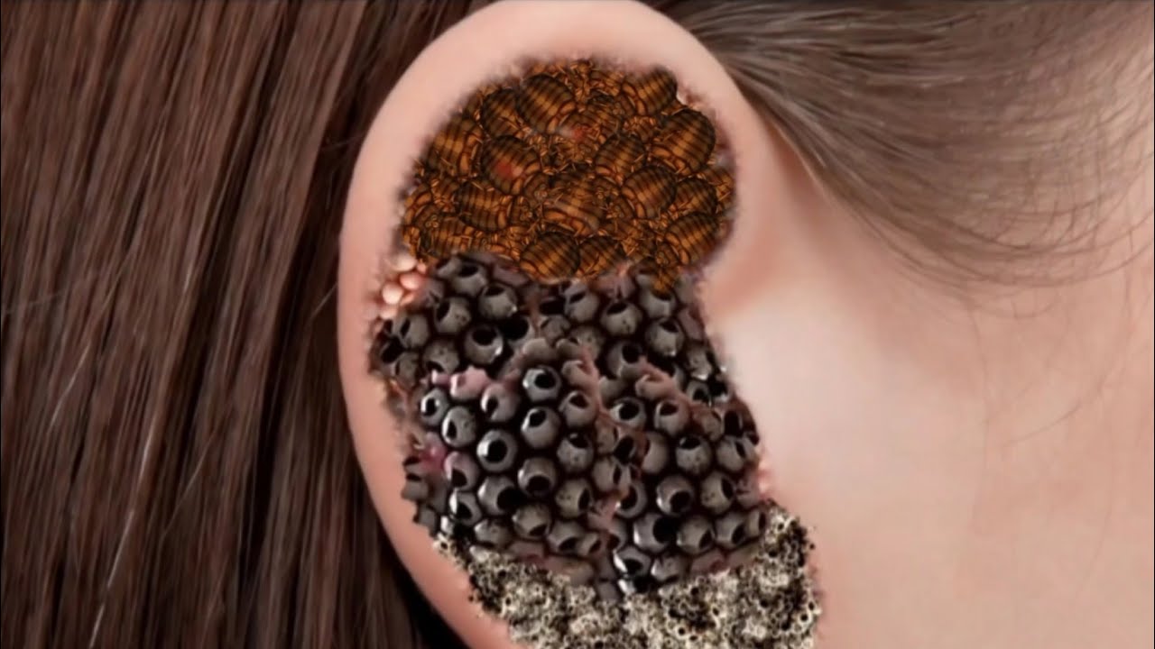 ASMR Animation Treatment 🤧 Infected Ear, Ear Treatment 2D Collection ...