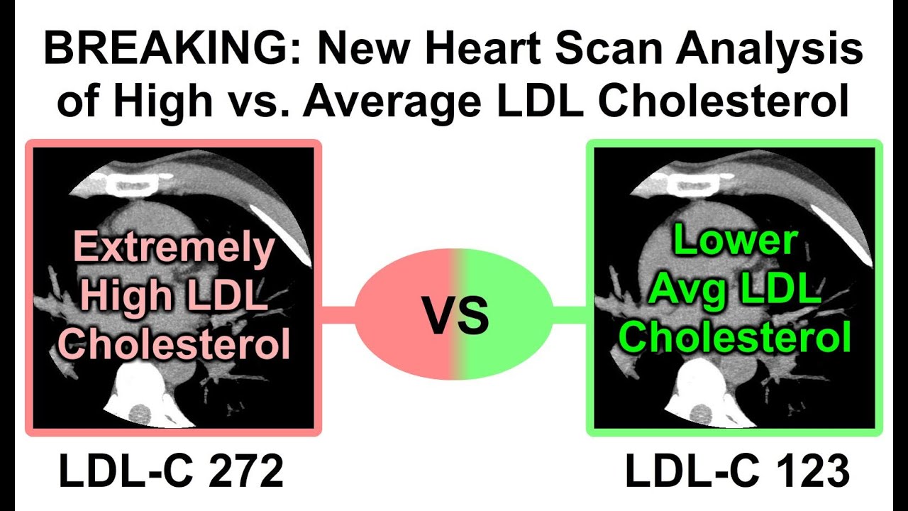BREAKING – Match Analysis on LMHR Study Released - YouTube