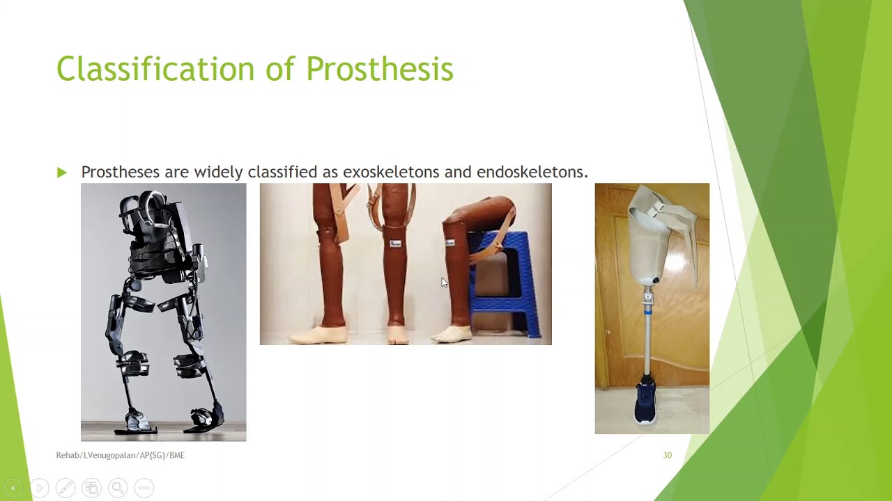 Components of prostheses - YouTube