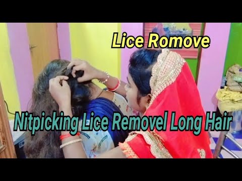 Lice Nitpicking Remove Haivy Lice And Long Hair For Girl| Nitspicking ...