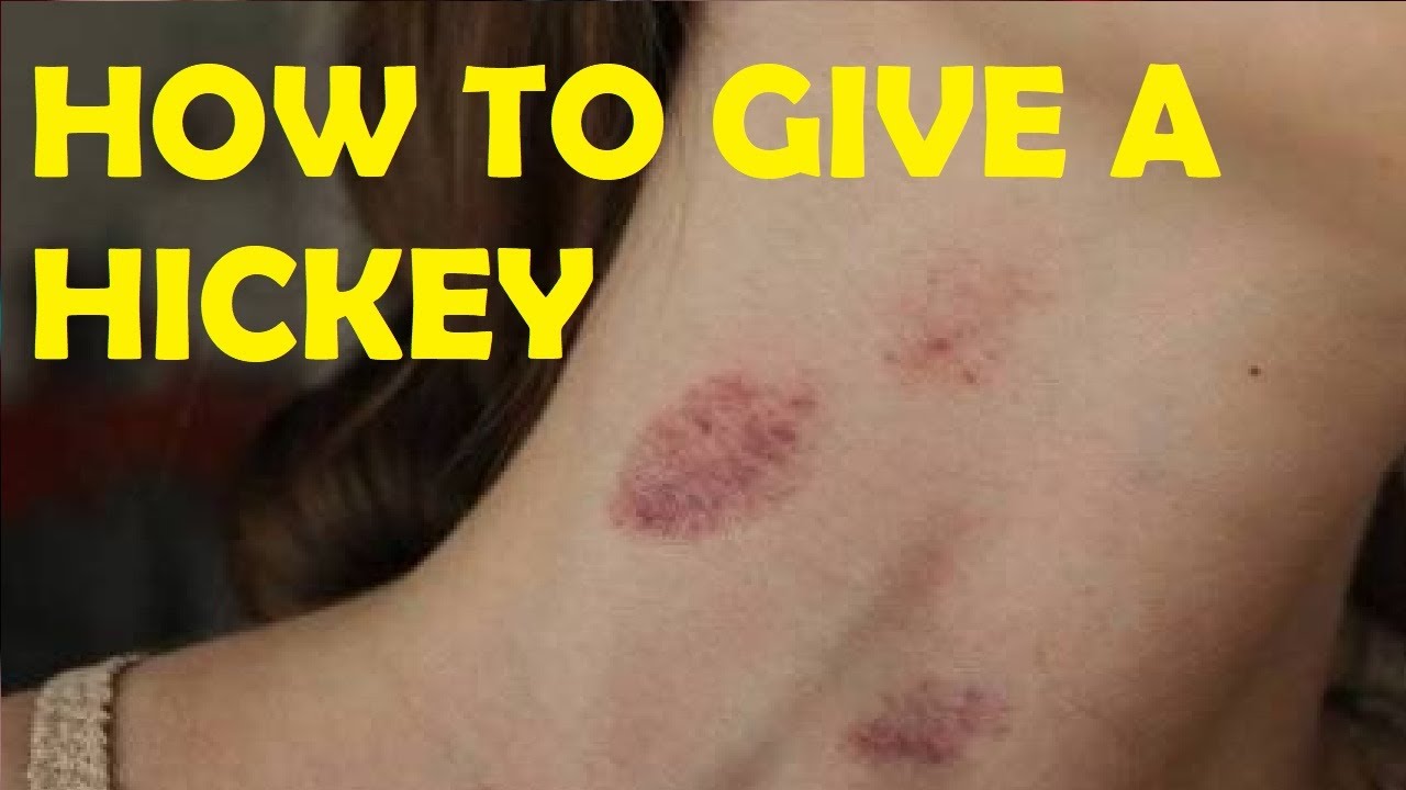 Learn How To Give Someone A Hickey Fast YouTube learn-how-to-give-someone-a-hickey-fast-youtube