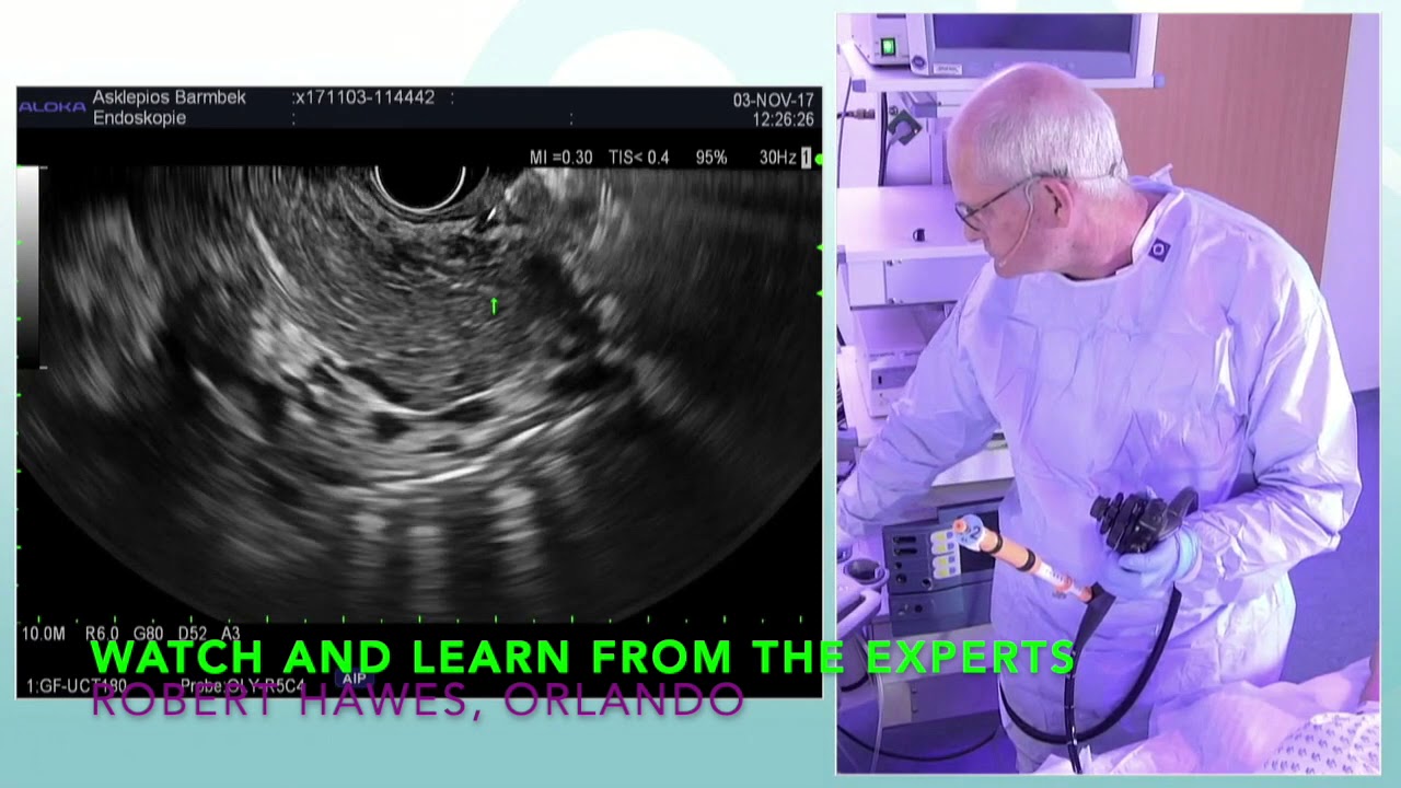 Endoscopy on Air June 5 - Register and listen to Rob Hawes - YouTube