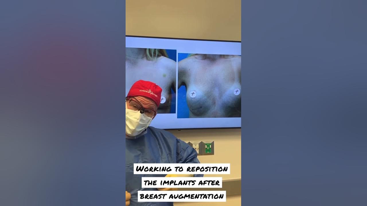 Patient Journey: Reshape and Reposition Breast Implants - YouTube
