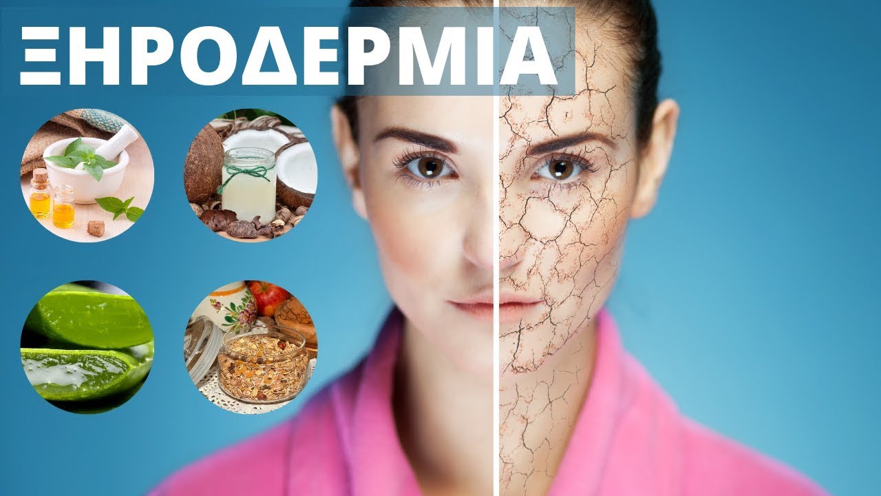 Ξηροδερμία Στο Πρόσωπο & Το Σώμα (4 Φυσικές Θεραπείες) - YouTube