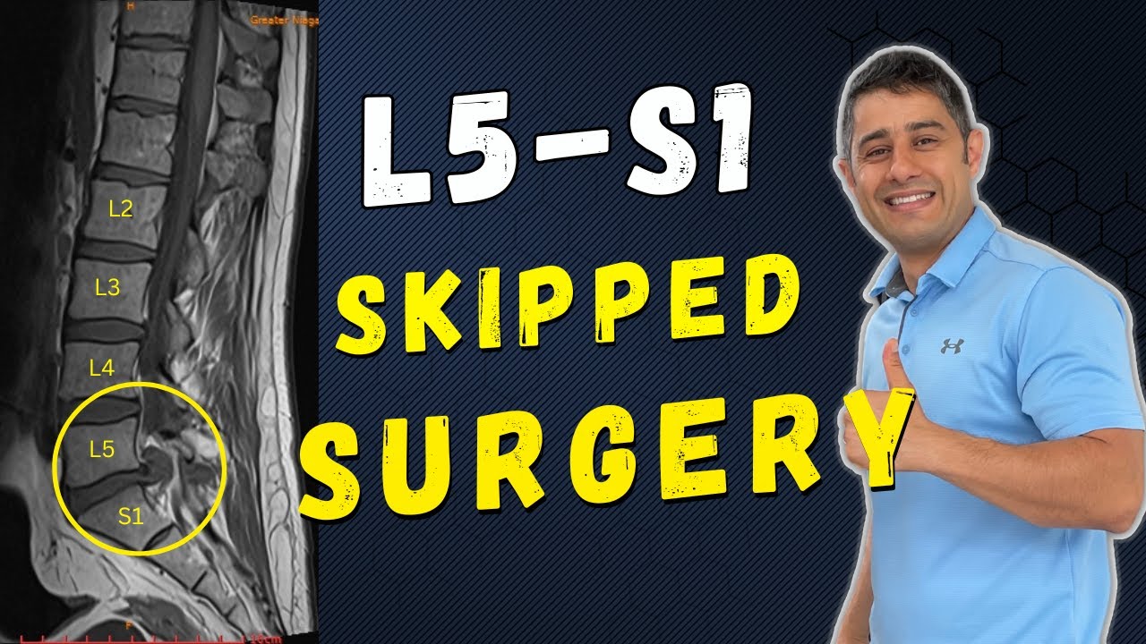 L5 - S1 Disc Herniation Recovery without surgery (online client ...