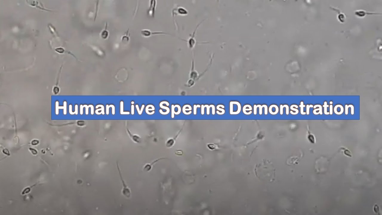 Human Sperm Under Microscope