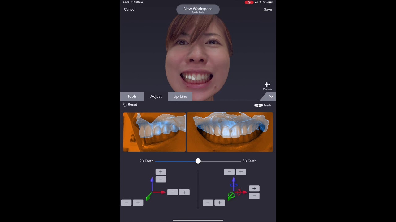 Adjust IOS data overlay on face model - YouTube