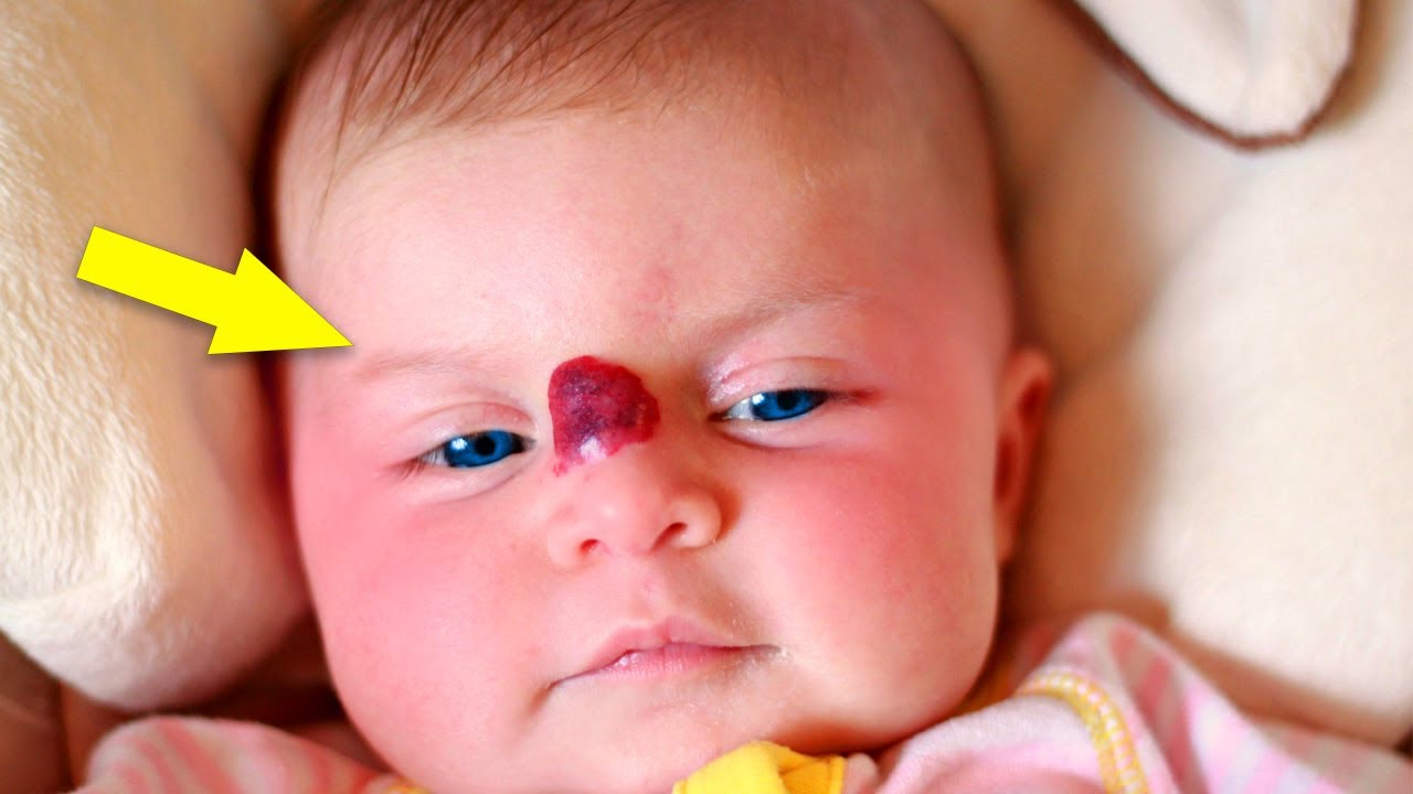 Everyone Laughed at This Girl Born with a Clown Nose. 3 Years Later ...