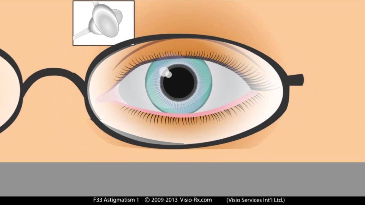 Test acuité visuel - Opticien-lentillescom