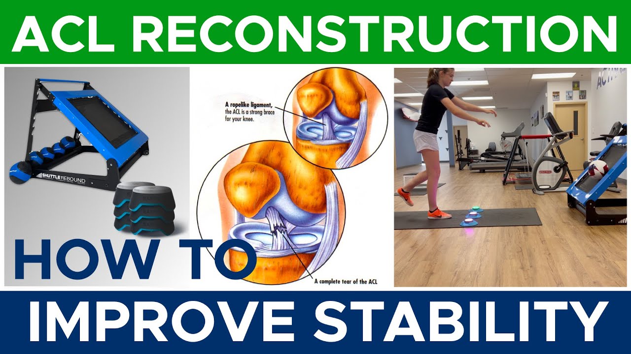 Improving Knee Stability After ACL Reconstruction With Gamification ...