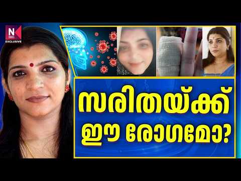 തന്റെ ഇപ്പോഴത്തെ അവസ്ഥയെ കുറിച്ച് വെളിപ്പെടുത്തൽ | Saritha S Nair health | News Kerala Exclusive