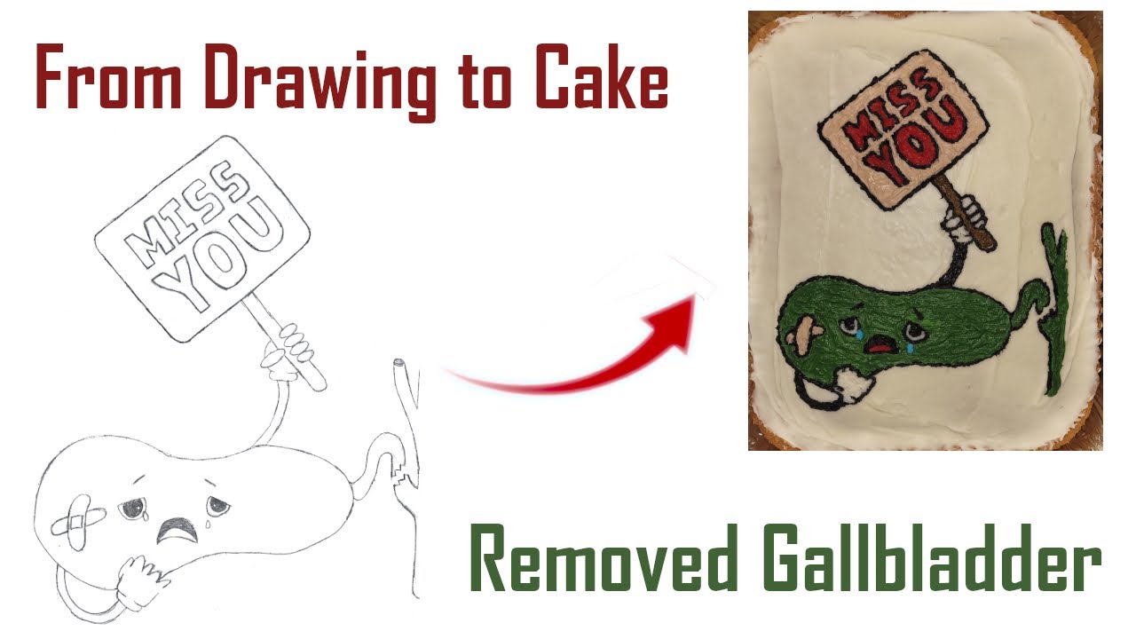 From Drawing to Cake - Removed Gallbladder - YouTube