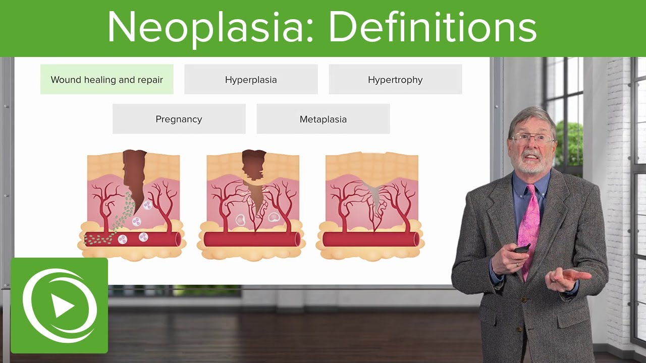 Neoplasia: Definitions - YouTube