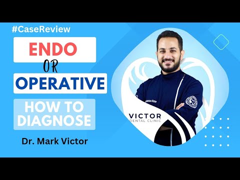 Endo or Operative how to diagnose well and make good ttt plan || Dr ...