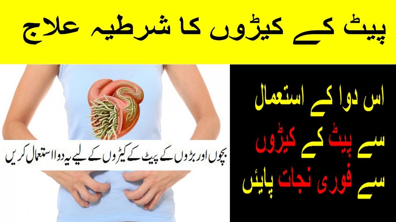 Intestinal worms symptoms & treatment | Simple treatment of worms - YouTube