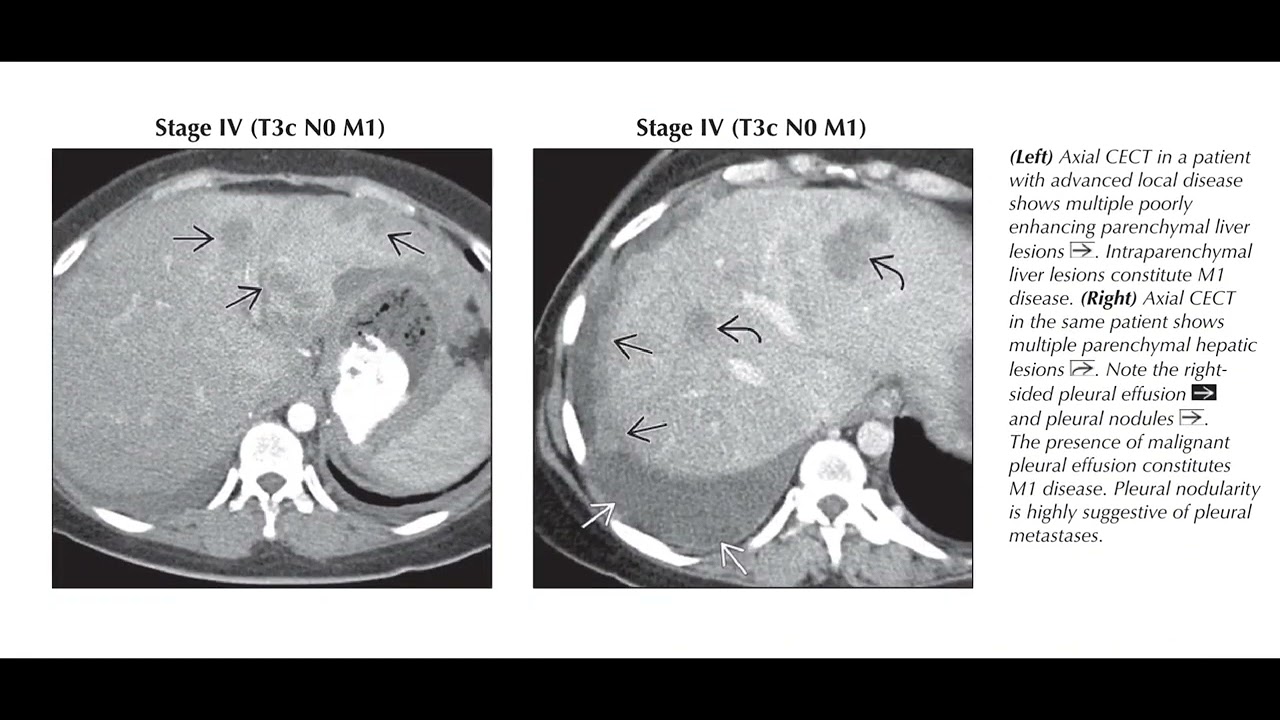 Gynae imaging Diagnostic imaging series (1) - YouTube