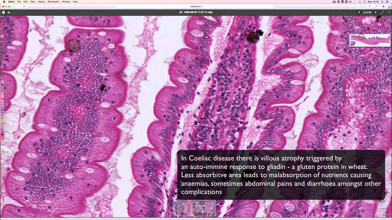 [DIAGRAM] Diagram Of Duodenum - MYDIAGRAM.ONLINE