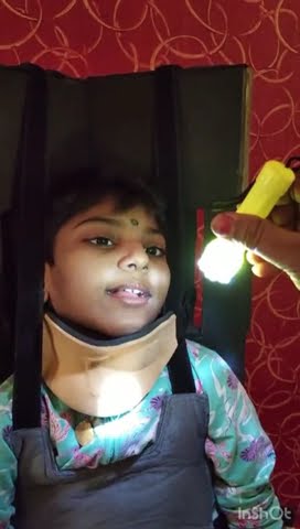 visual stimulation is the process of stimulating the eye's retina with ...