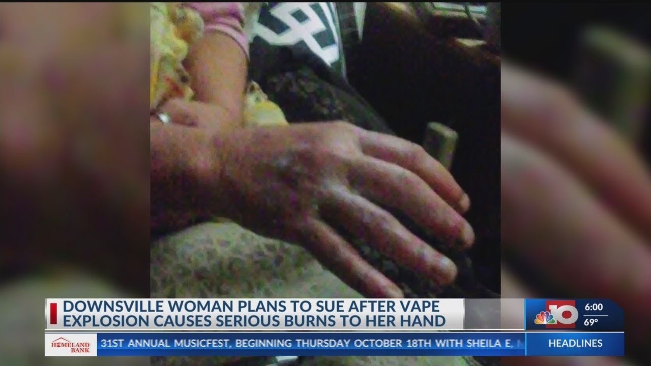 Vape explosion injures Downsville woman - YouTube
