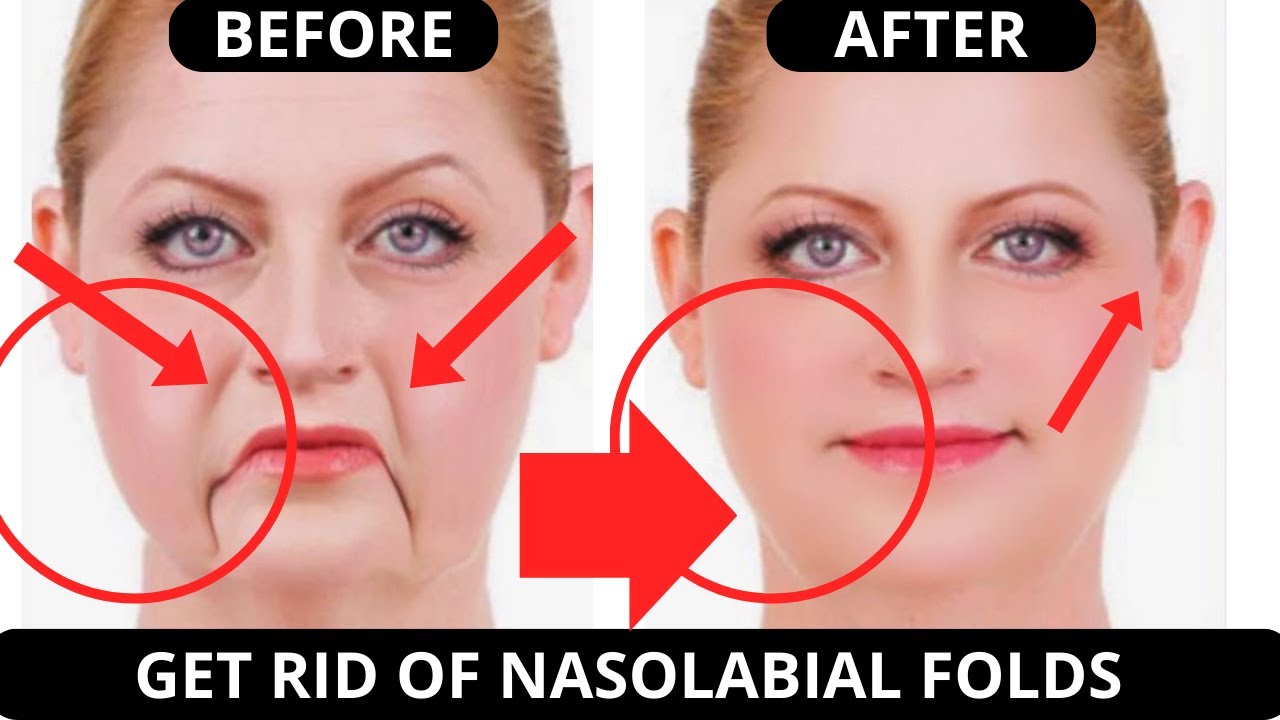 Easy Face Exercises to Erase Laugh Lines & Nasolabial Folds | Target ...